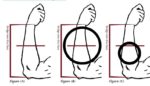How to Use The Wing Chun Ring - Everything Wing Chun® Blog